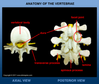 Common Spinal Conditions - ShimSpine