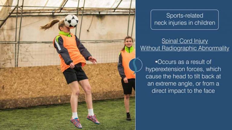 Sports-Related Cervical Injuries in Children - ShimSpine